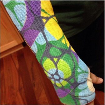 16 People Making The Best Out Of A Bad Situation With Their Casts