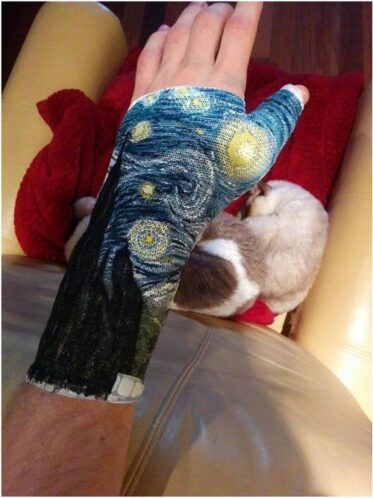 16 People Making The Best Out Of A Bad Situation With Their Casts