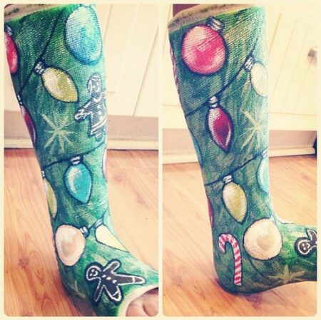 16 People Making The Best Out Of A Bad Situation With Their Casts