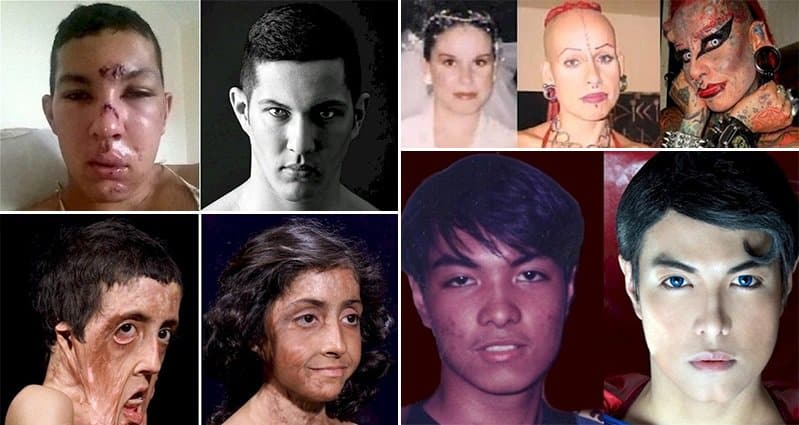 13 Unbelievable Physical Transformations That Will Amaze You