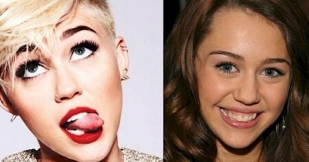 9 Before And After Comparison Photos Of Celebrity Nose Jobs