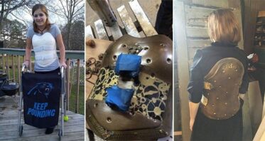 See How This Girl Transformed Her Back Brace Into The Most Awesome ...