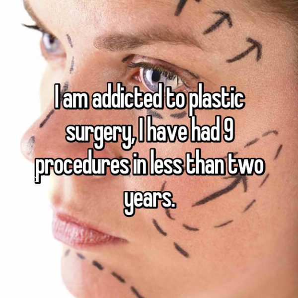 People Share Their Stories Of Addiction To Plastic Surgery