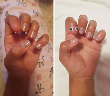 30 Unique People Whose Genetics Made Them Remarkably Different