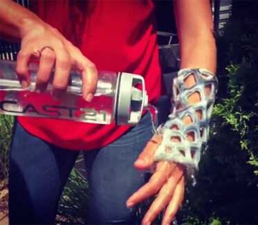A Company Has Created A New Waterproof Cast Called 'Osteon Defender'