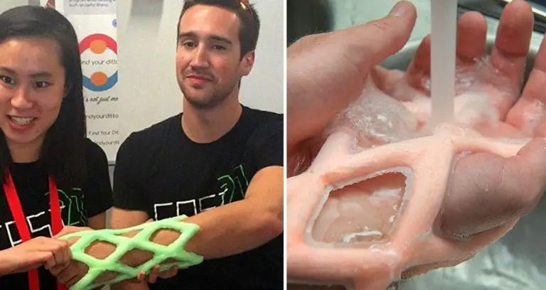 A Company Has Created A New Waterproof Cast Called 'Osteon Defender'