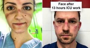 26 Heartbreaking Photos Of Overworked Doctors Are Going Viral As They ...