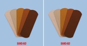 Band-Aid Is Releasing A New Range Of Bandages To Match Different Skin Tones