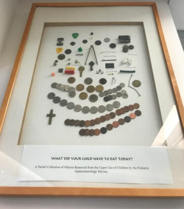 People Are Sharing Photos Of Unusual And Strange Collections