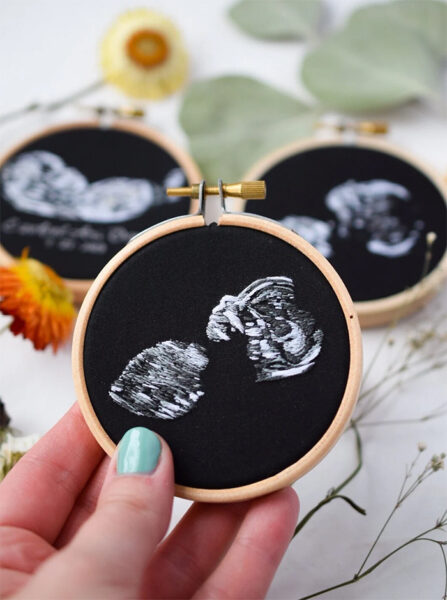 You Can Have Your Ultrasound Photos Embroidered